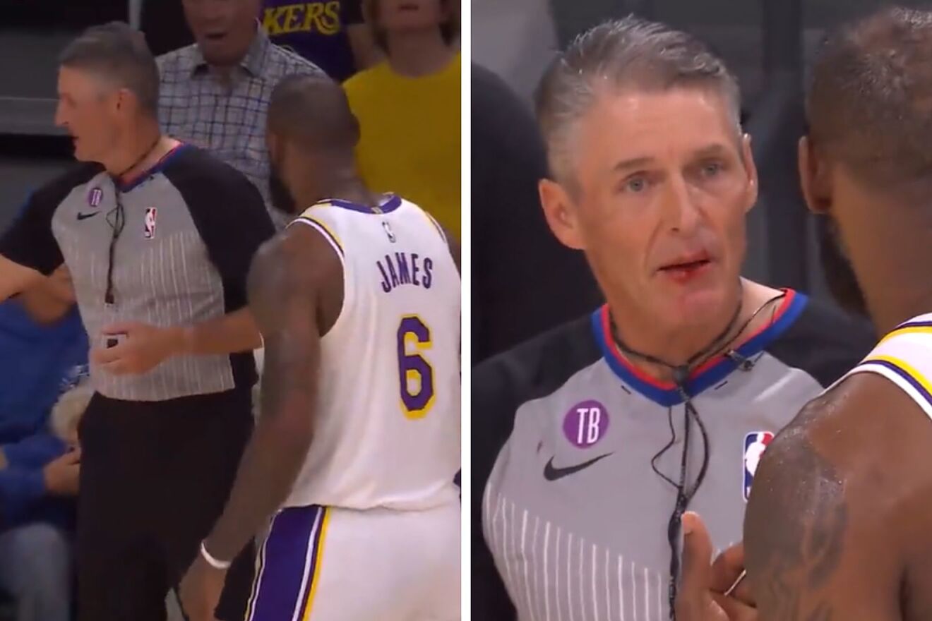 LeBron James makes Scott Foster bleed in Lakers loss to Nuggets | Marca