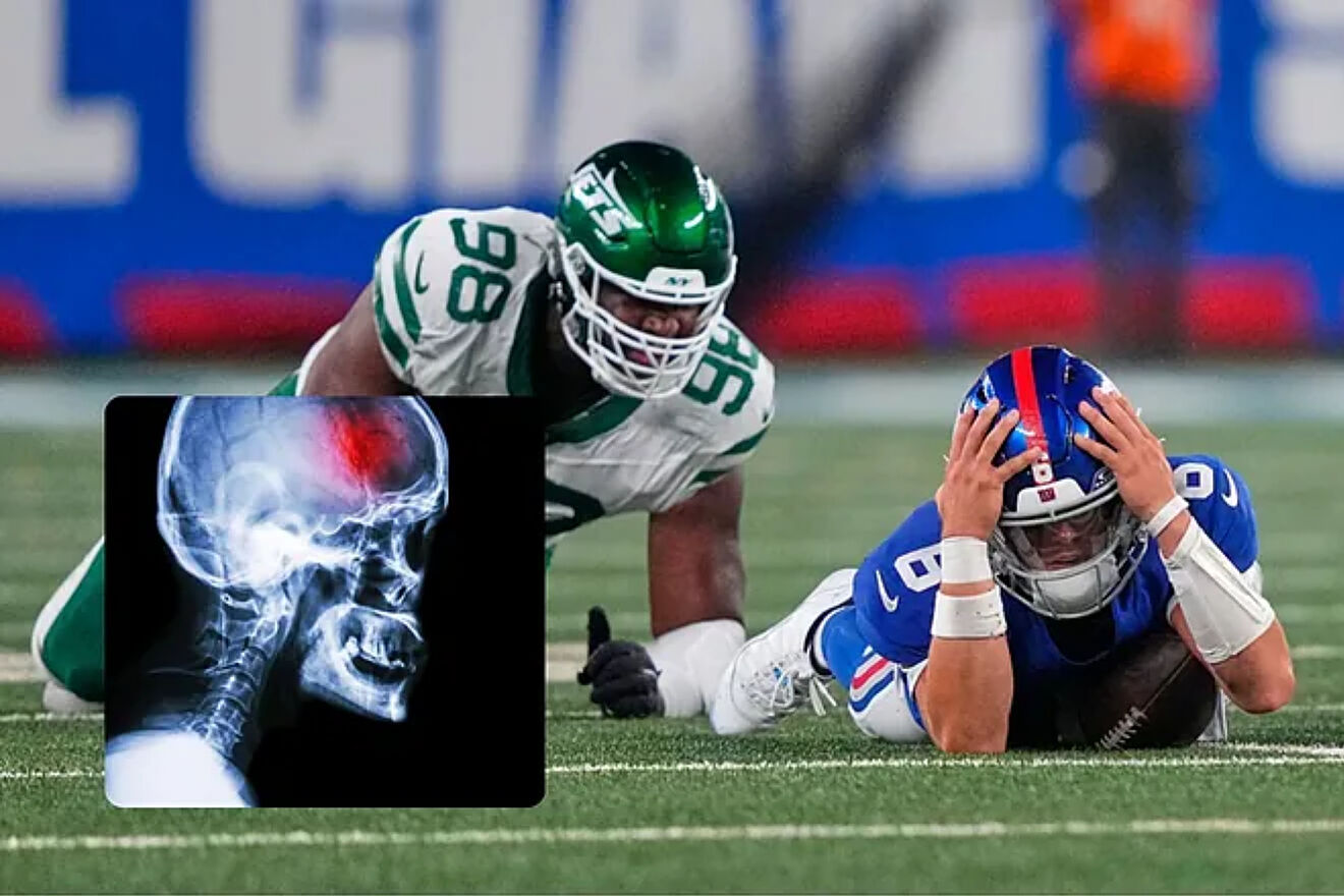 Concussions are at an all-time low in the NFL, but sexual gestures and ...