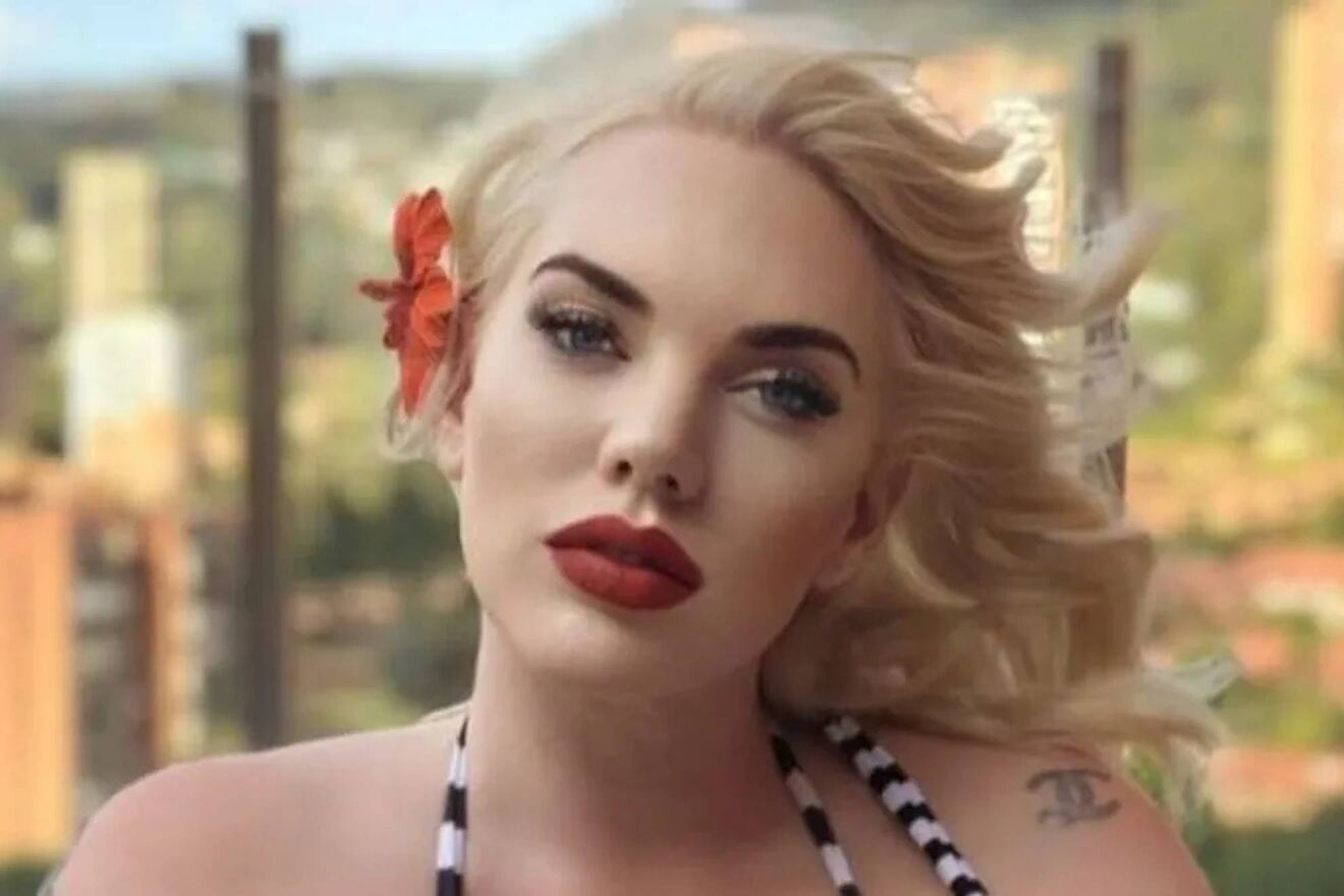 Model Jennifer Barlow has her leg amputated due to flesh-eating ...