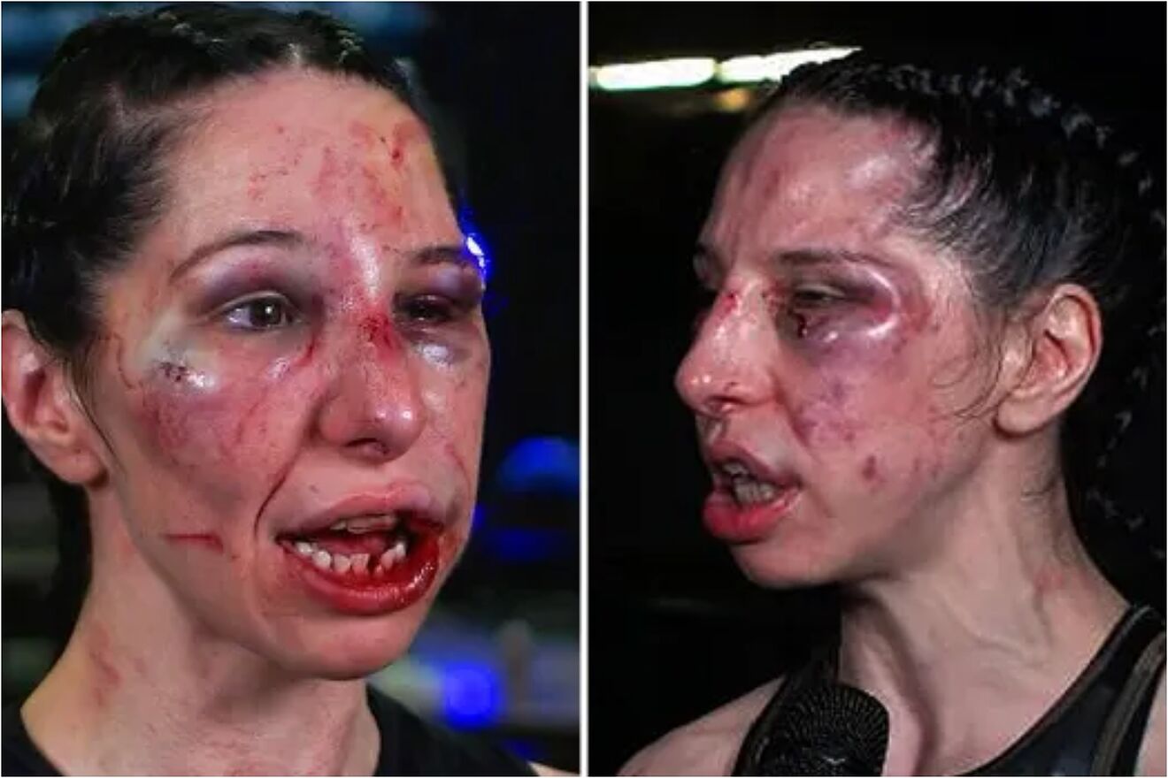 Boxing: Surprising confession from fighter who lost two teeth in the ...